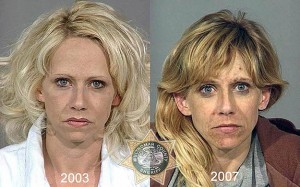 Shocking: The Effects Of Drug Addiction On The Face | Bit Rebels