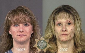 Shocking: The Effects Of Drug Addiction On The Face | Bit Rebels