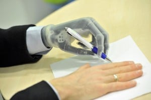 World's First App-Controlled Prosthetic Hand Allows Natural Functions ...
